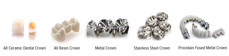 typesofcrowns